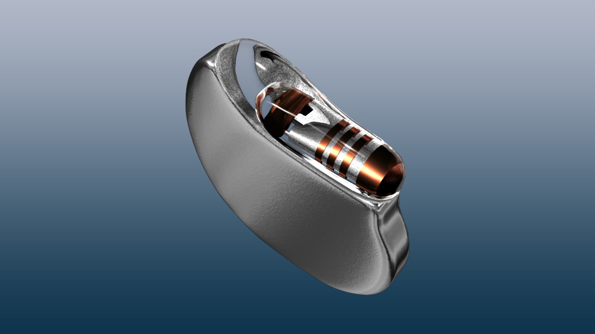 Artificial Cardiac Pacemaker 3D Model - TurboSquid 1223036