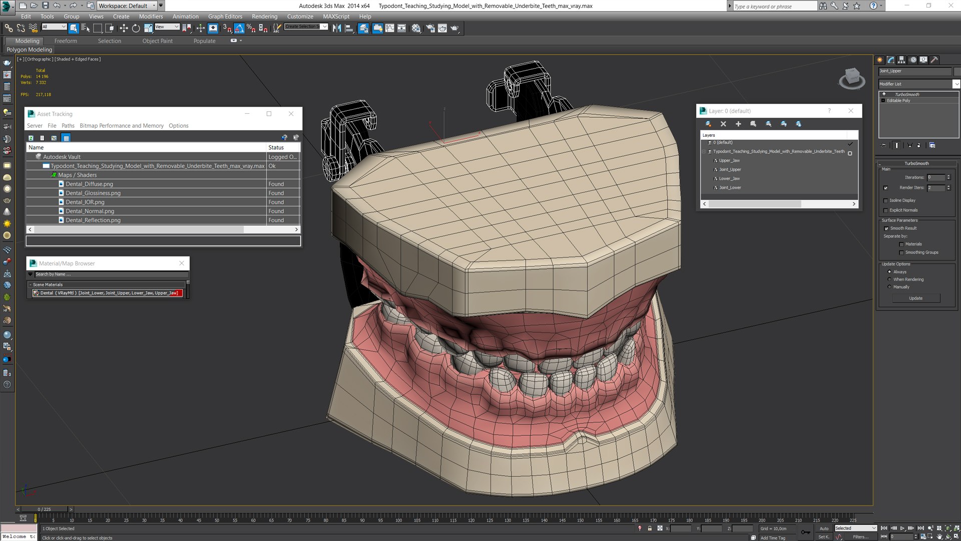 3D Model Typodont Teaching Studying Model With Removable Underbite ...