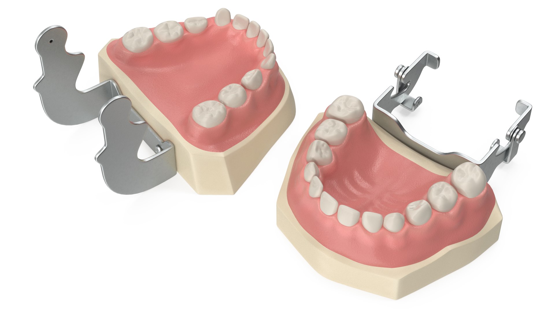 3D Model Typodont Teaching Studying Model With Removable Underbite ...