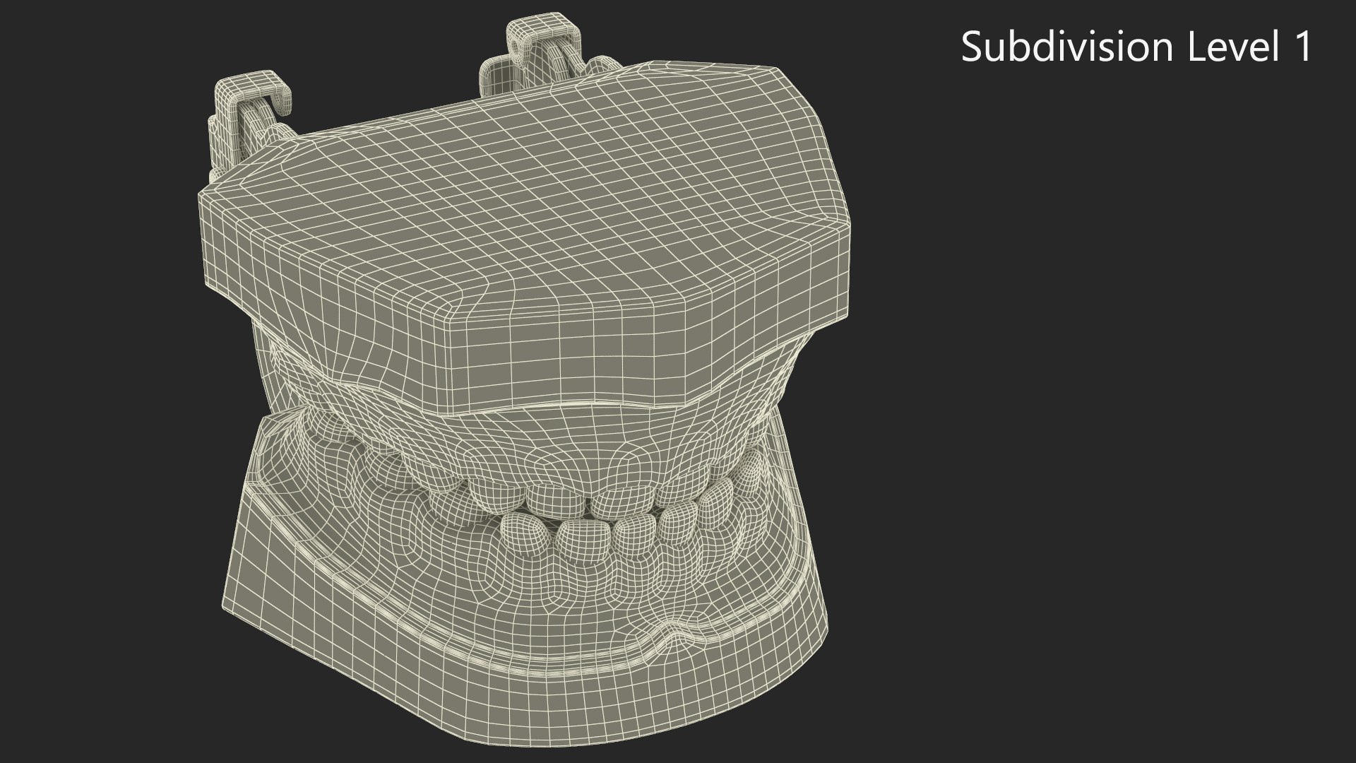 3D Model Typodont Teaching Studying Model With Removable Underbite ...