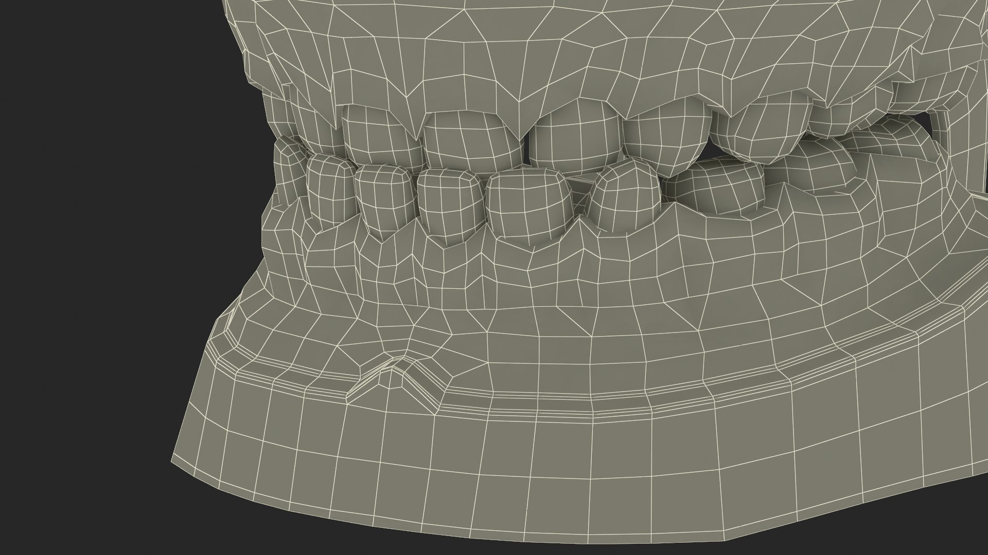 3D model Typodont Teaching Studying Model with Removable Underbite ...