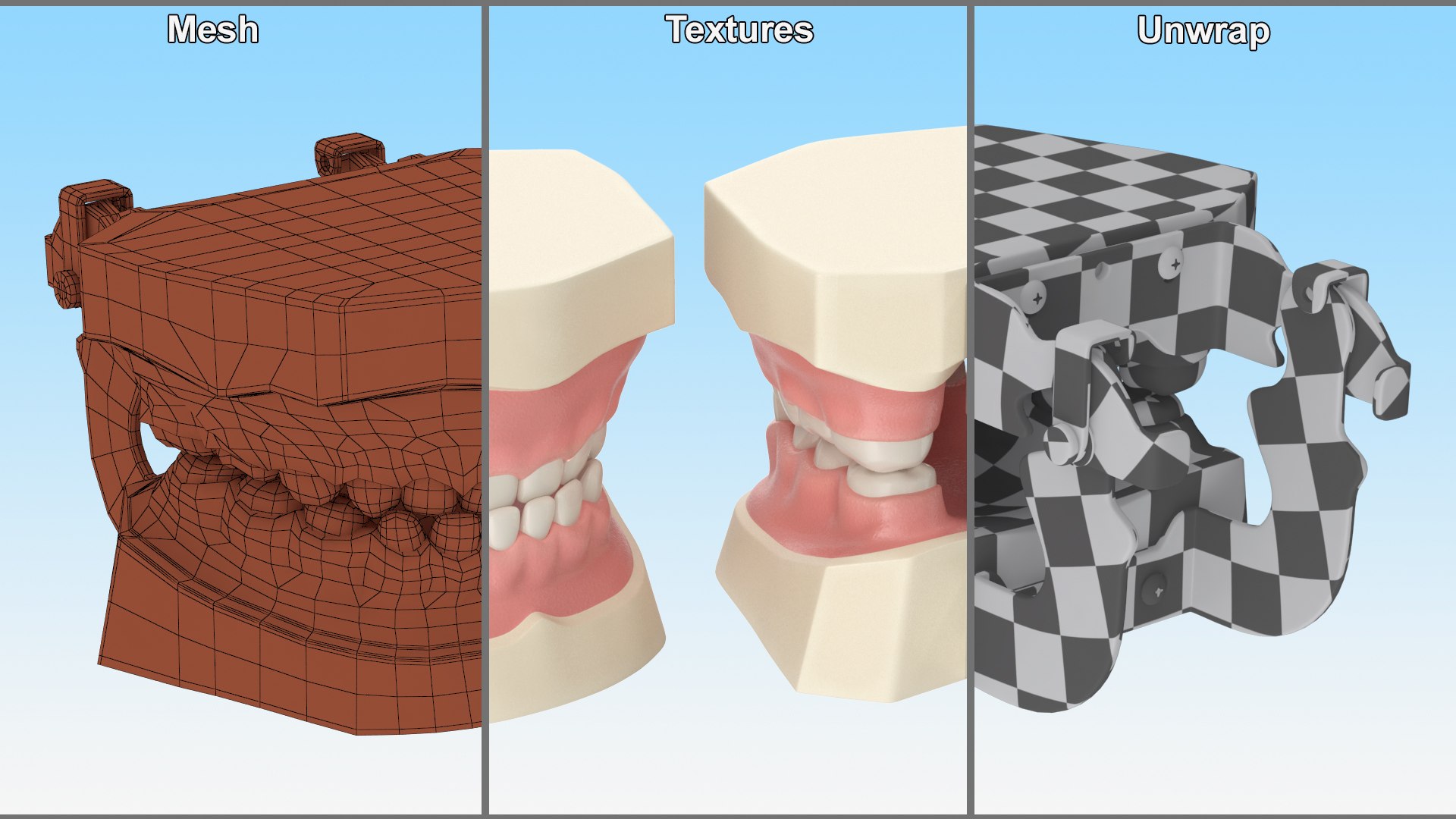 3D Model Typodont Teaching Studying Model With Removable Underbite ...