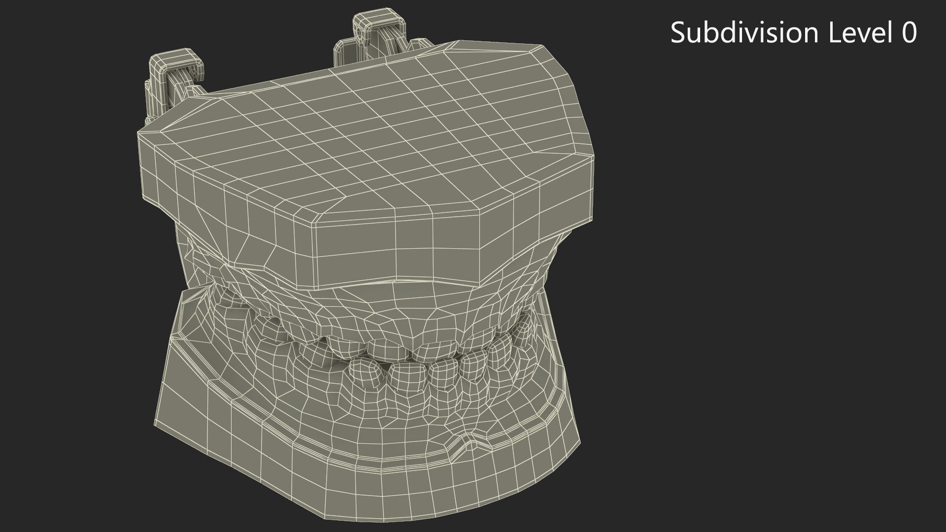 3D Model Typodont Teaching Studying Model With Removable Underbite ...