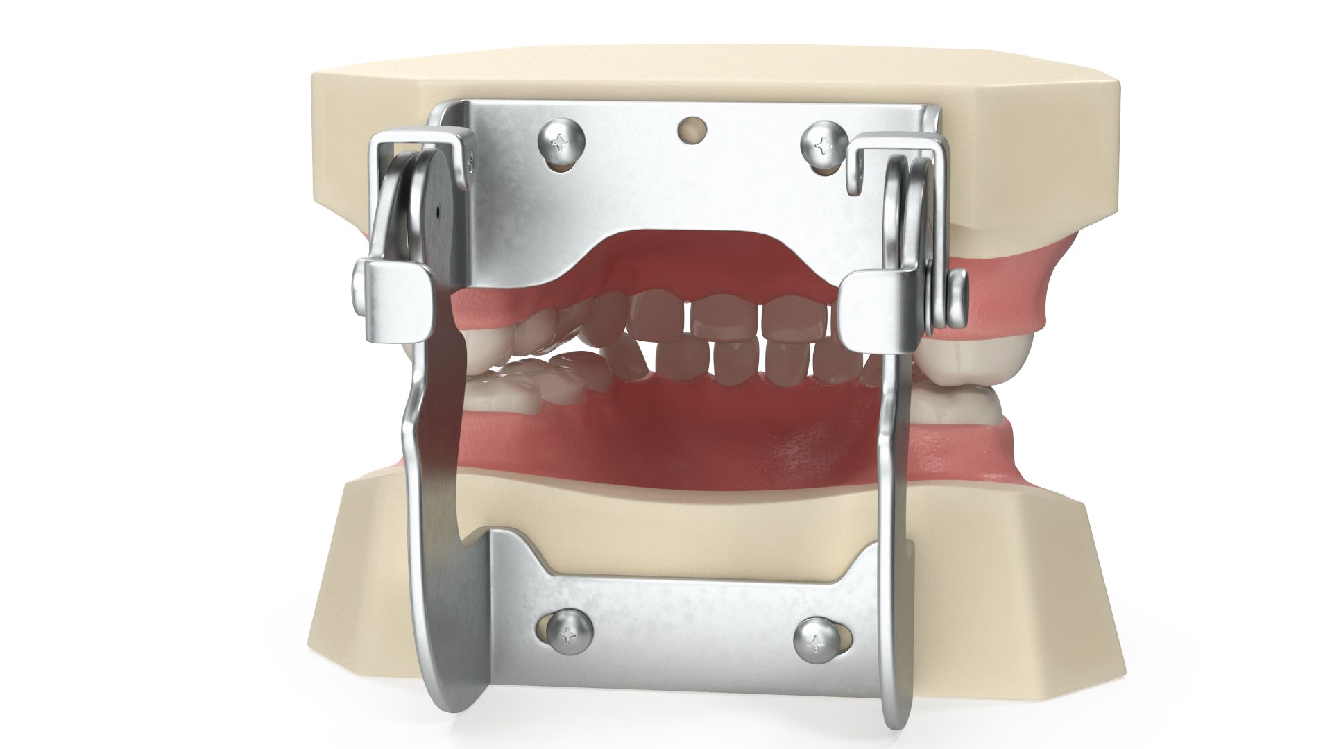 3D Model Typodont Teaching Studying Model With Removable Underbite ...