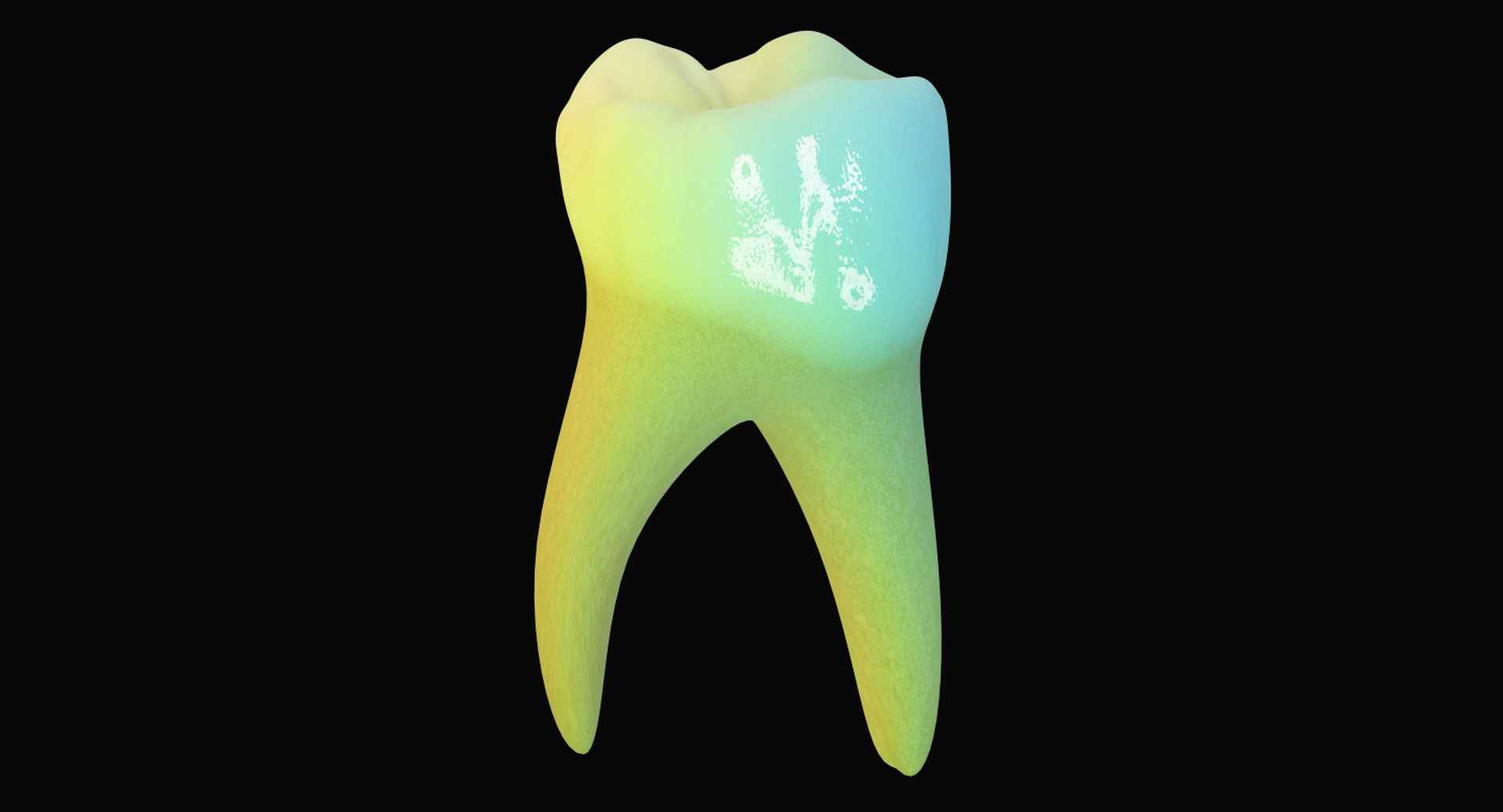 Primary Molar Lower 3d Max