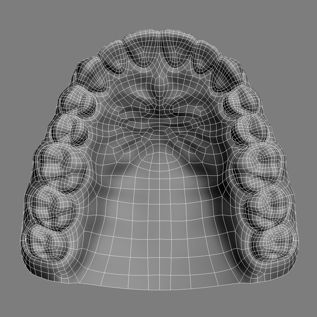 realistic orthodontics medicine 3d model