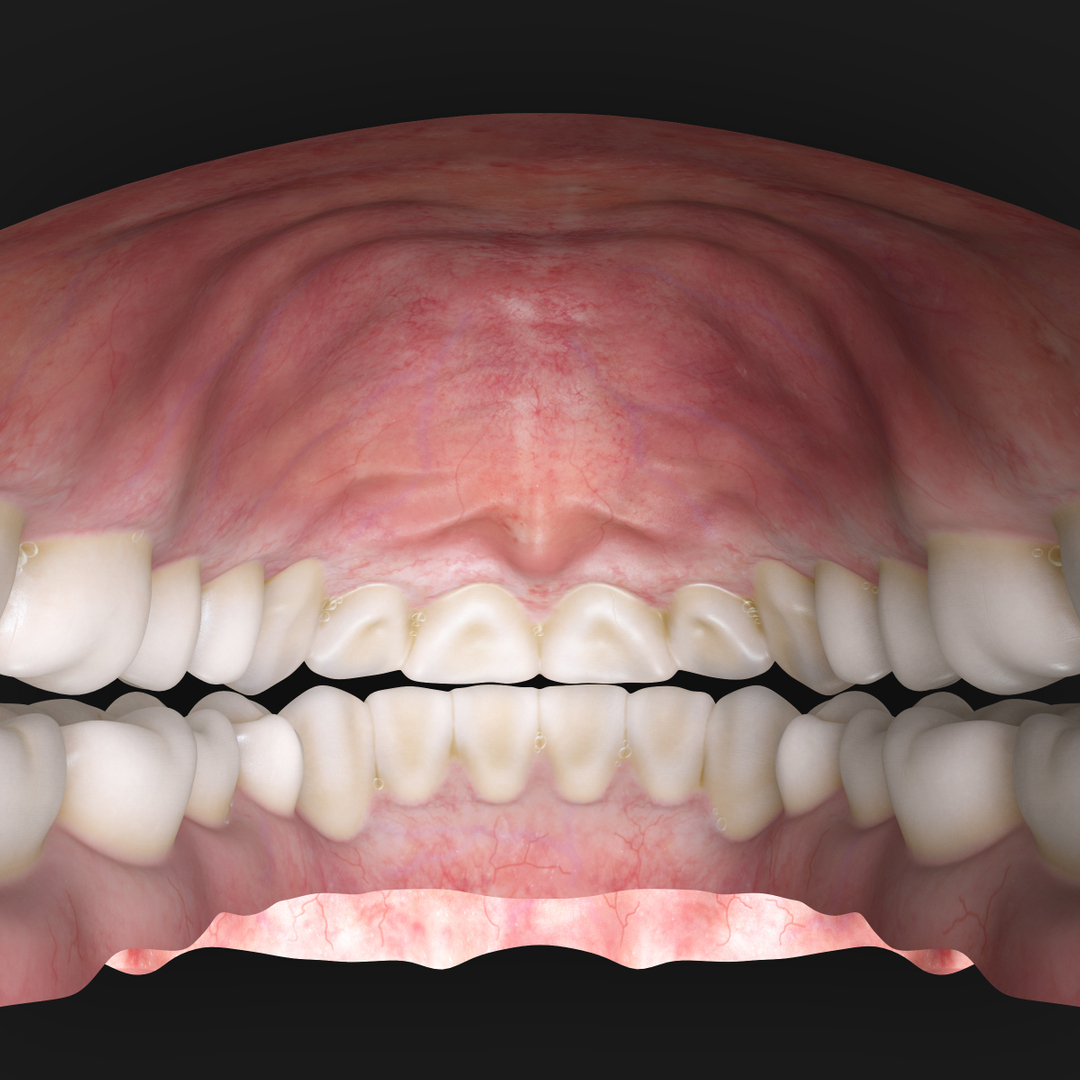 realistic orthodontics medicine 3d model