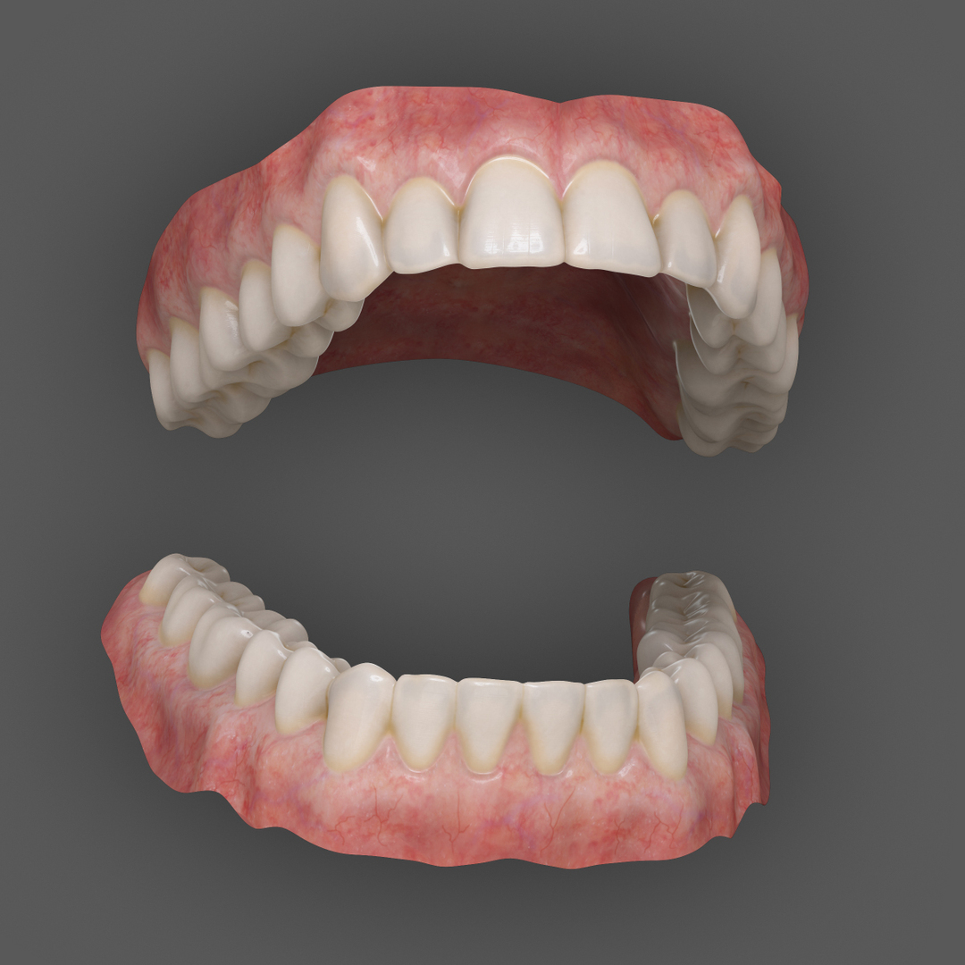realistic orthodontics medicine 3d model