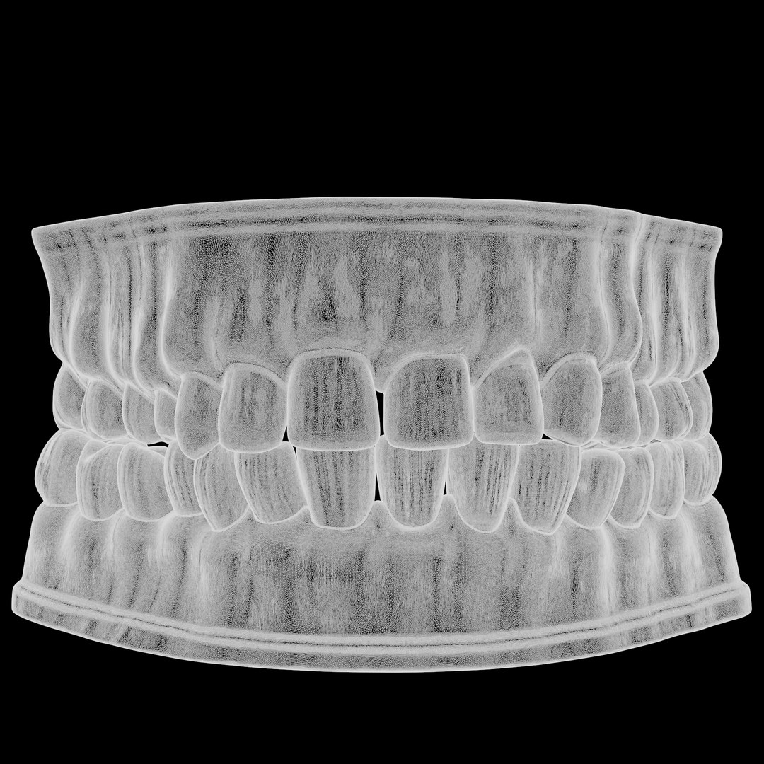 3D Dentures D Mold Model - TurboSquid 1826796
