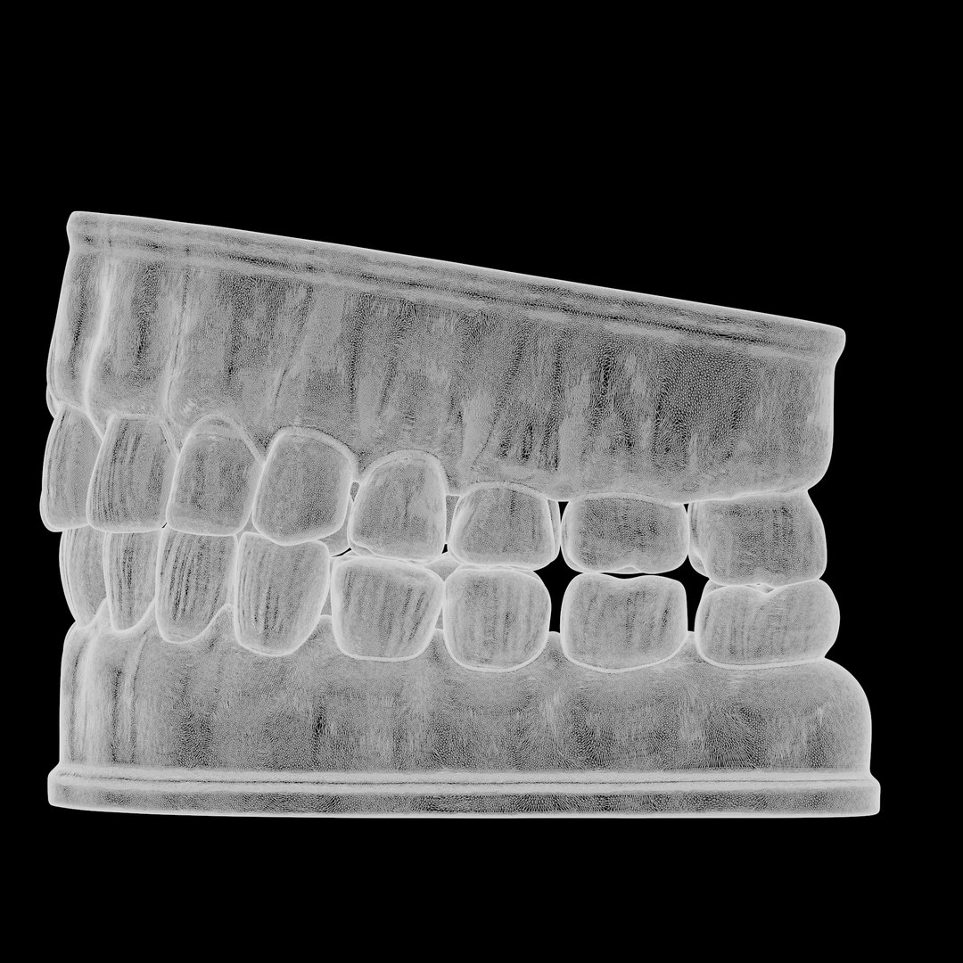 3D Dentures D Mold Model - TurboSquid 1826796