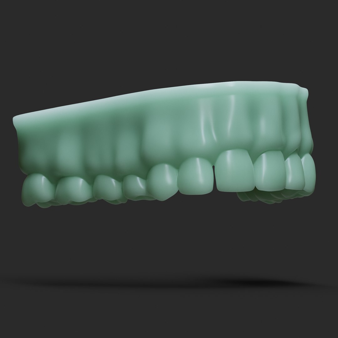 3D Dentures D Mold Model - TurboSquid 1826796