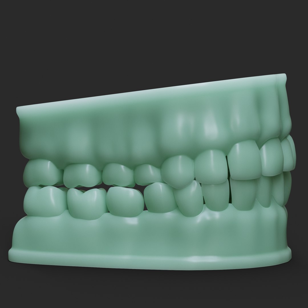 3D Dentures D Mold Model - TurboSquid 1826796
