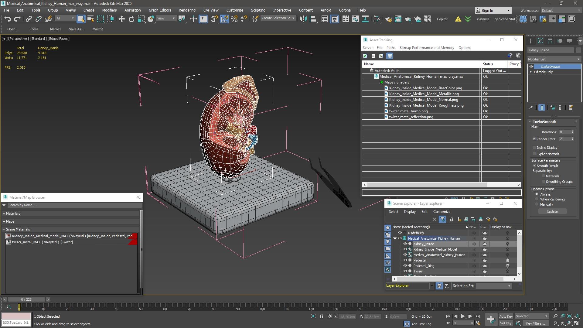 3D Medical Anatomical Kidney Human - TurboSquid 2343664
