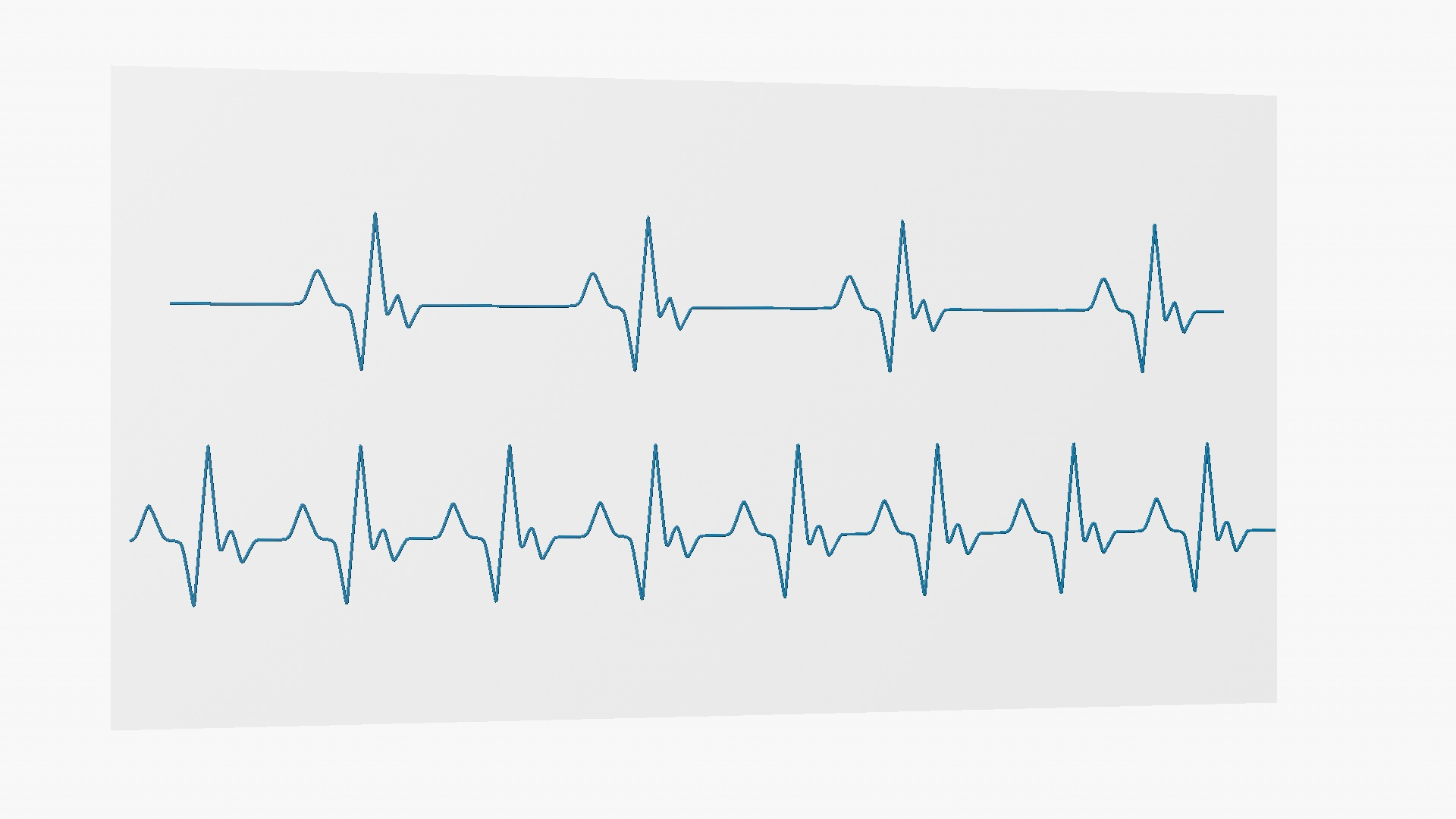 3D EKG Heartbeat Line Model - TurboSquid 2367994