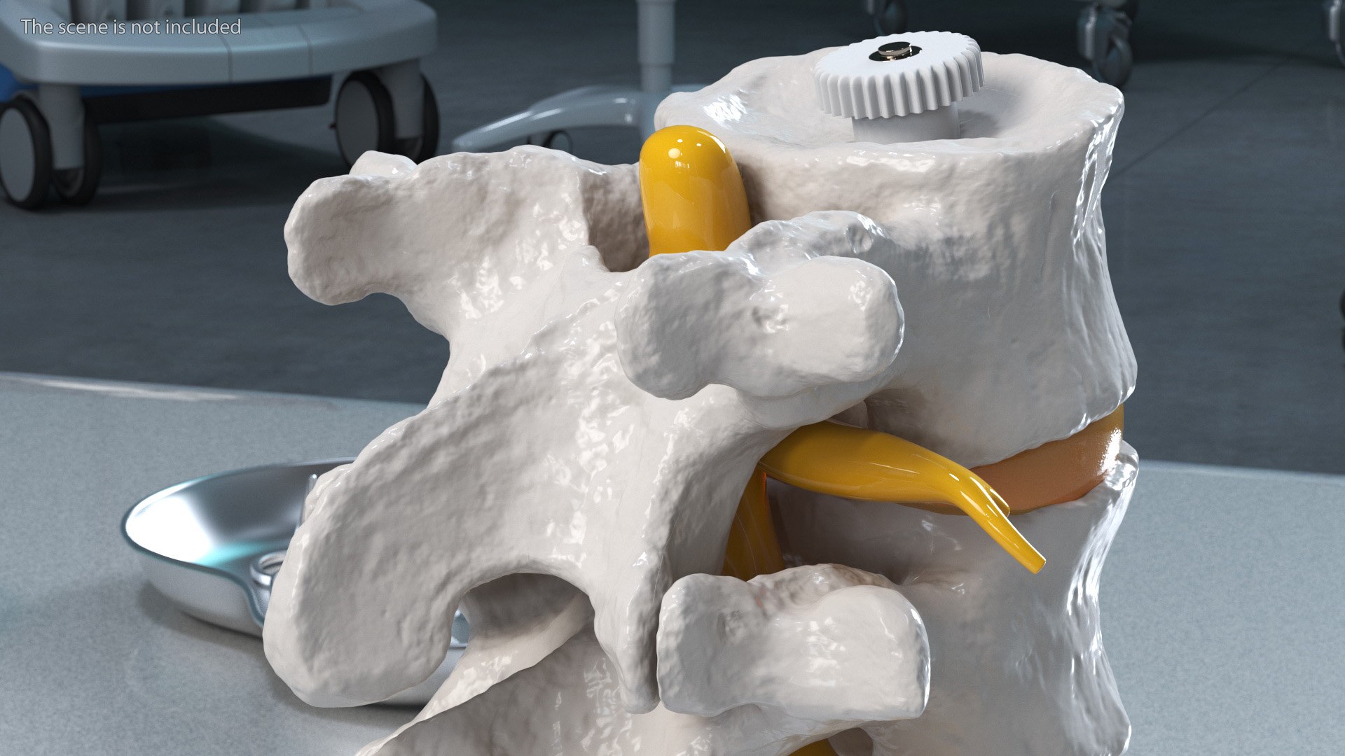 3D Part Of Spinal Column With Hernia Model - TurboSquid 2047604