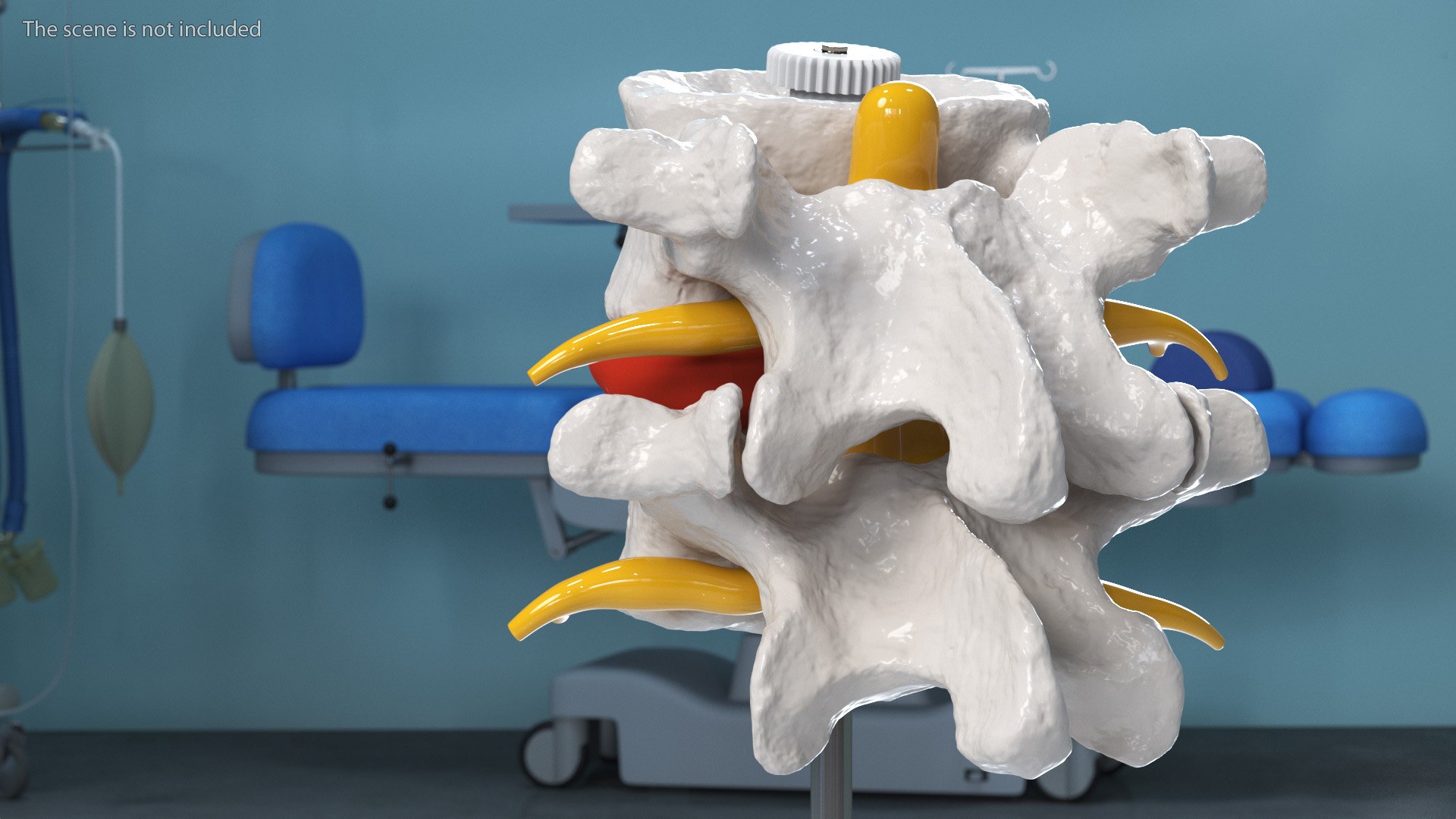 3D Part Of Spinal Column With Hernia Model - TurboSquid 2047604
