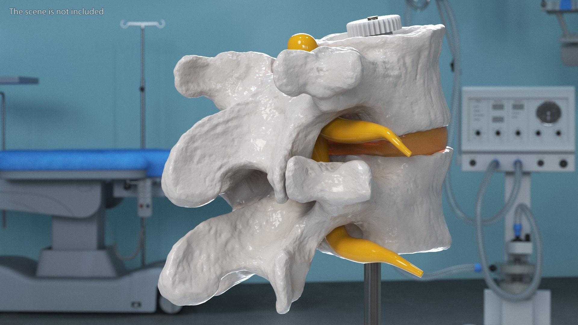 3D Part Of Spinal Column With Hernia Model - TurboSquid 2047604