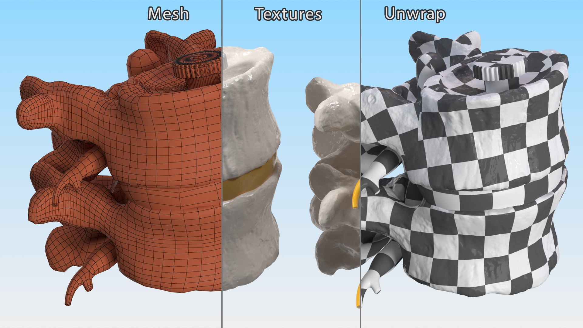 3D Part Of Spinal Column With Hernia Model - TurboSquid 2047604