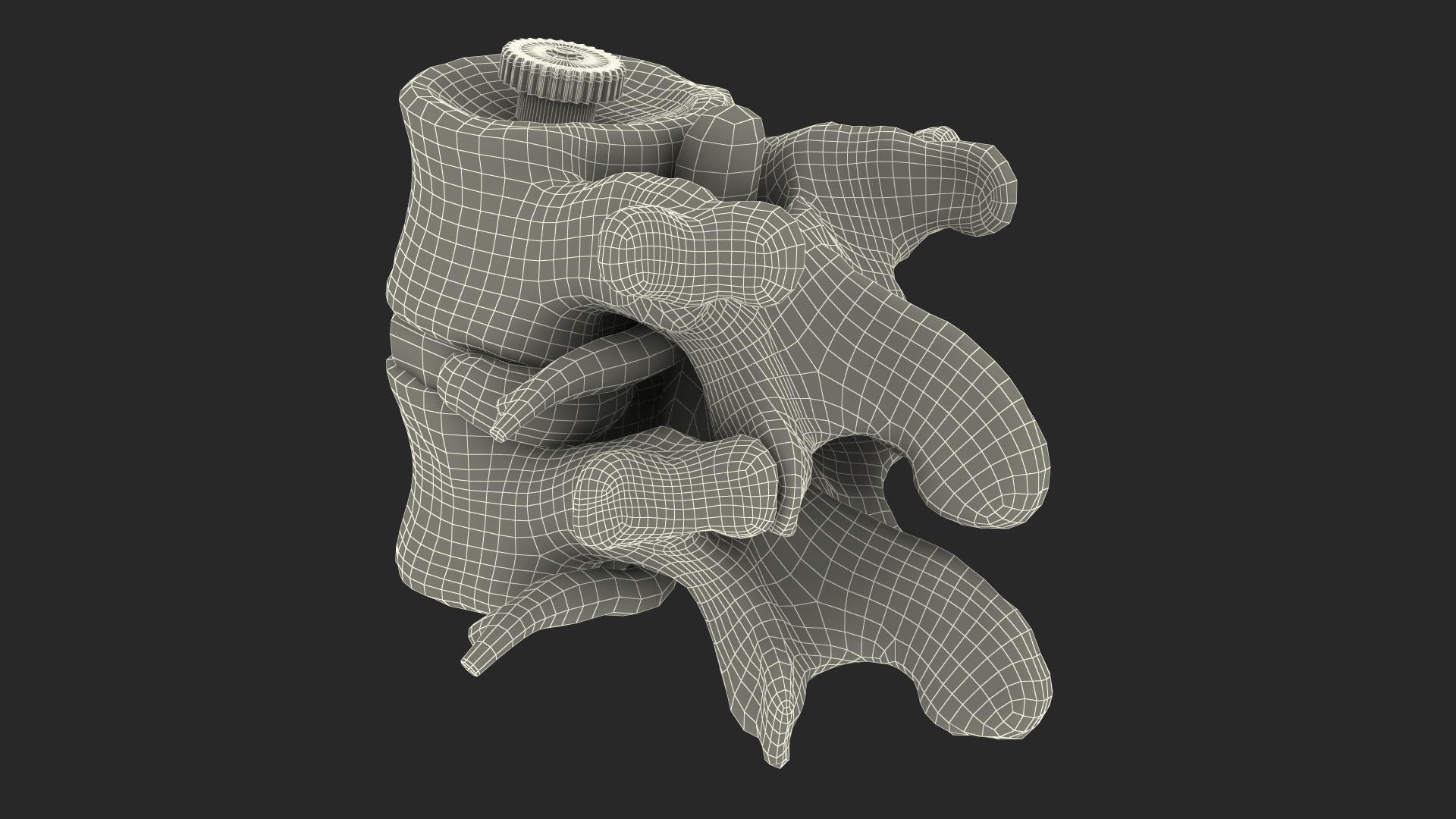 3D Part Of Spinal Column With Hernia Model - TurboSquid 2047604