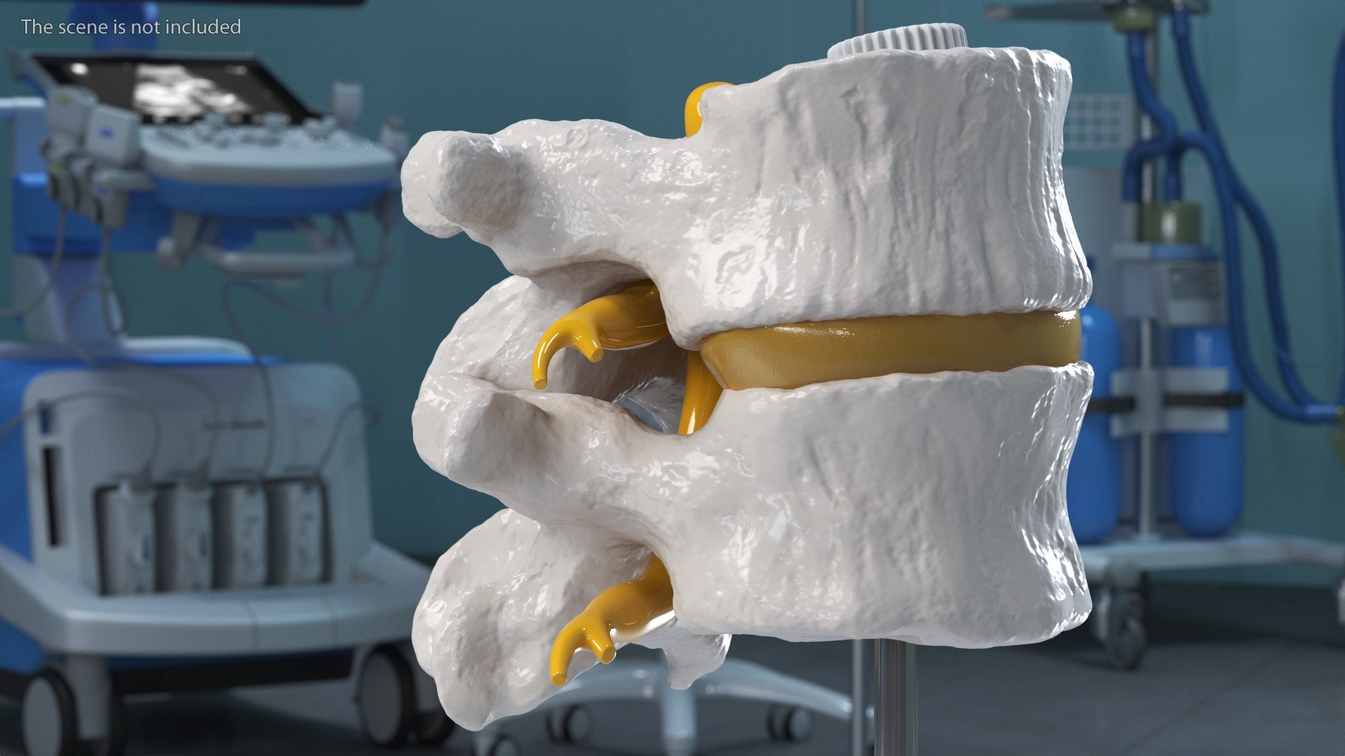 3D Part Of Spinal Column With Hernia Model - TurboSquid 2047604