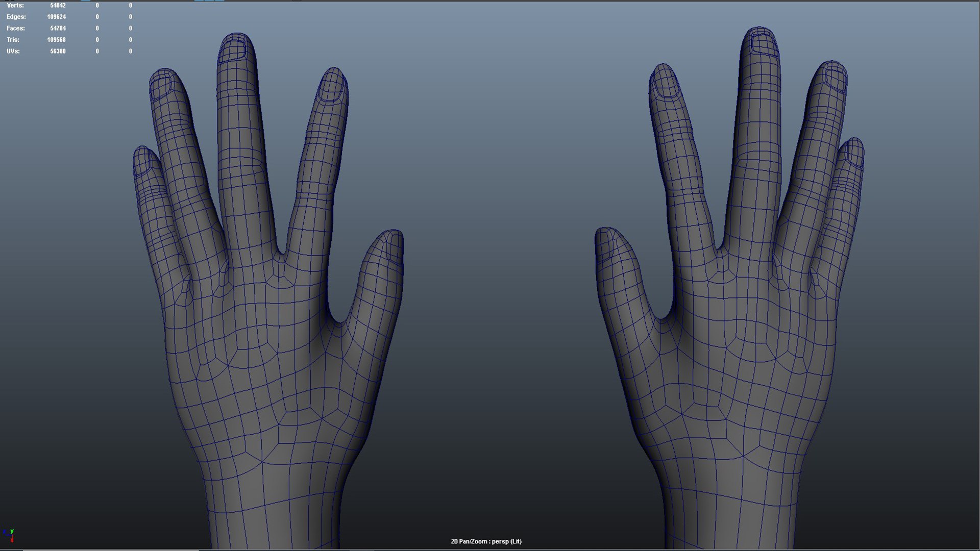 3D Vitiligo Leucoderma Skin Disease - TurboSquid 2184626