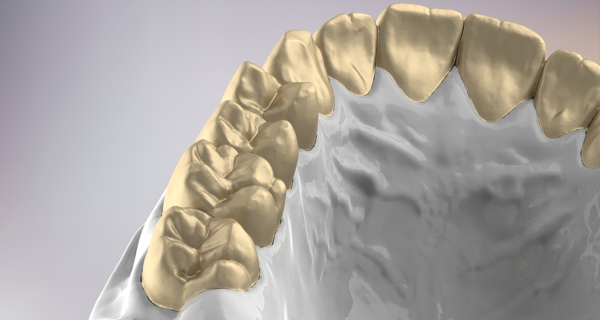 3D Dental Jaws Replica With Detachable Teeth - TurboSquid 2102102