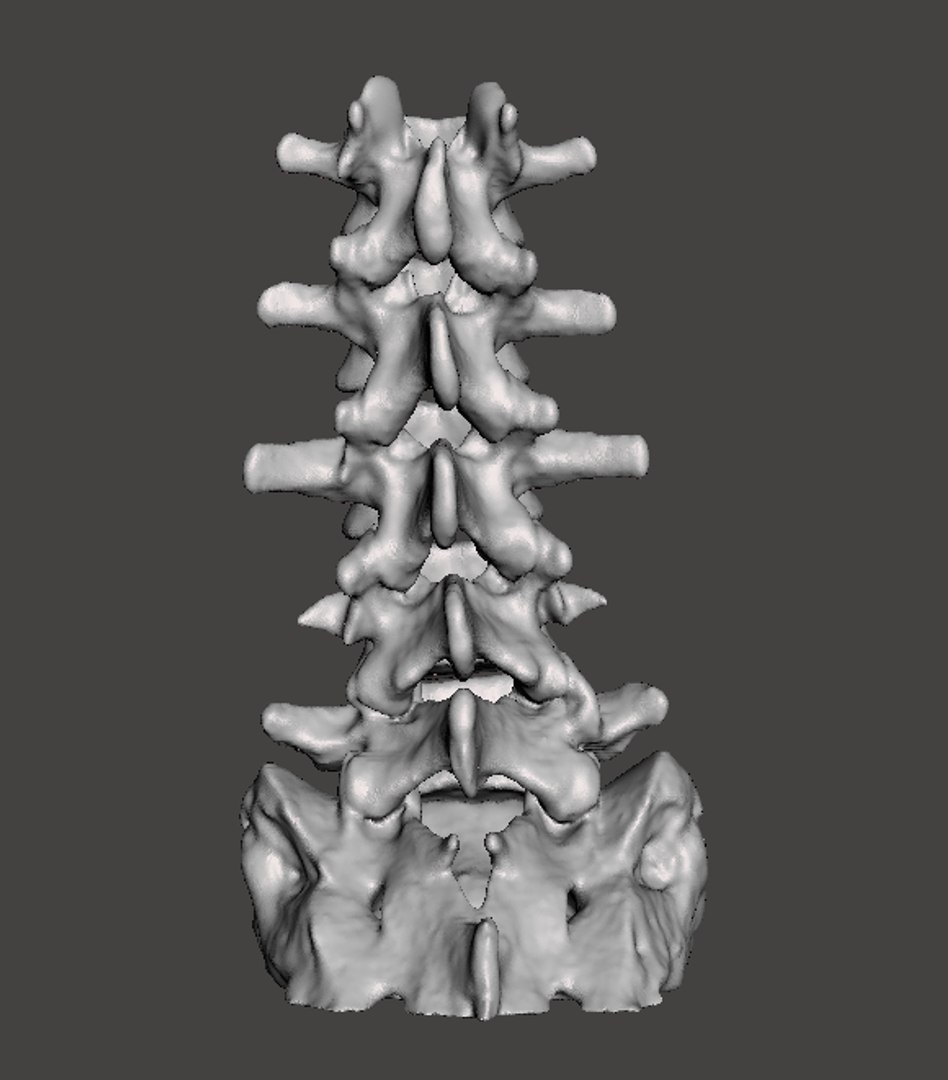 Human Vertebrae 3d Model