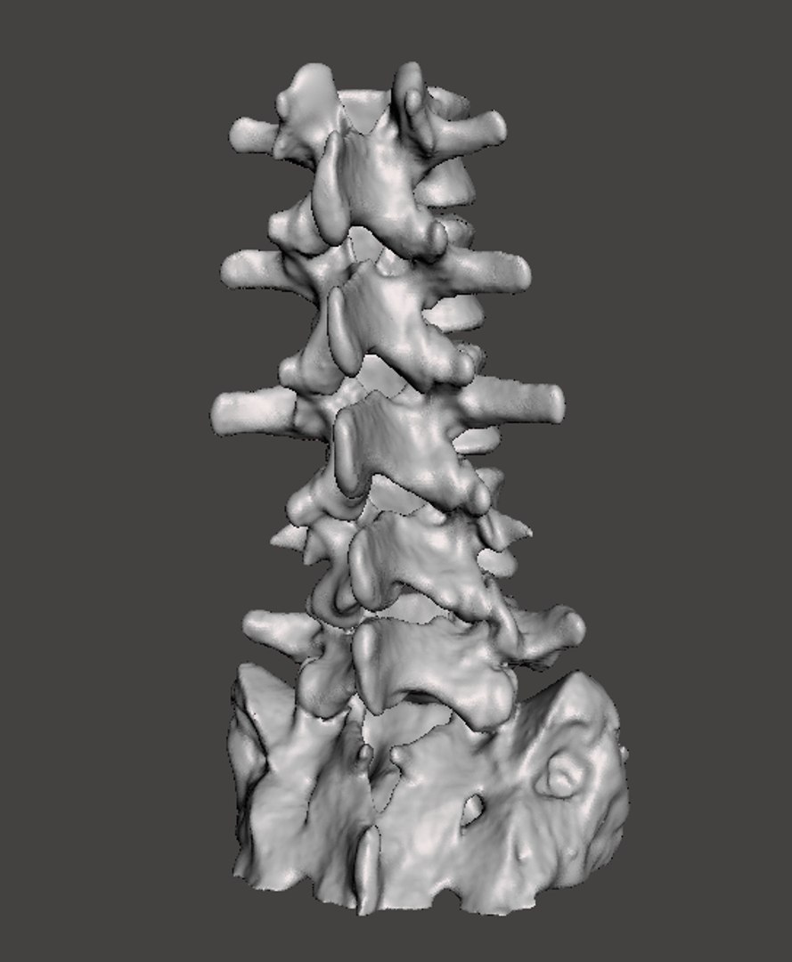 Human Vertebrae 3d Model