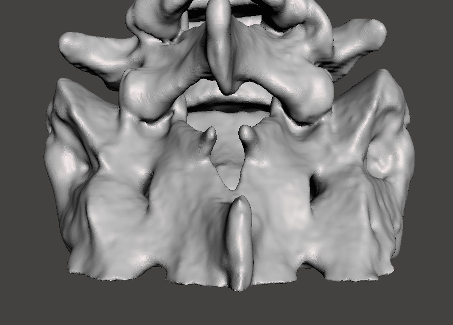 Human Vertebrae 3d Model