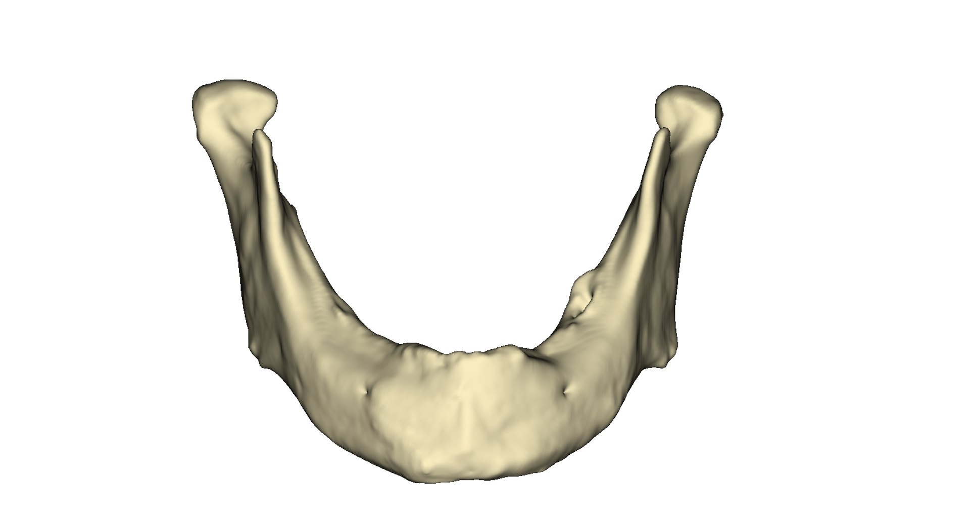 3d Edentulous Human Mandible