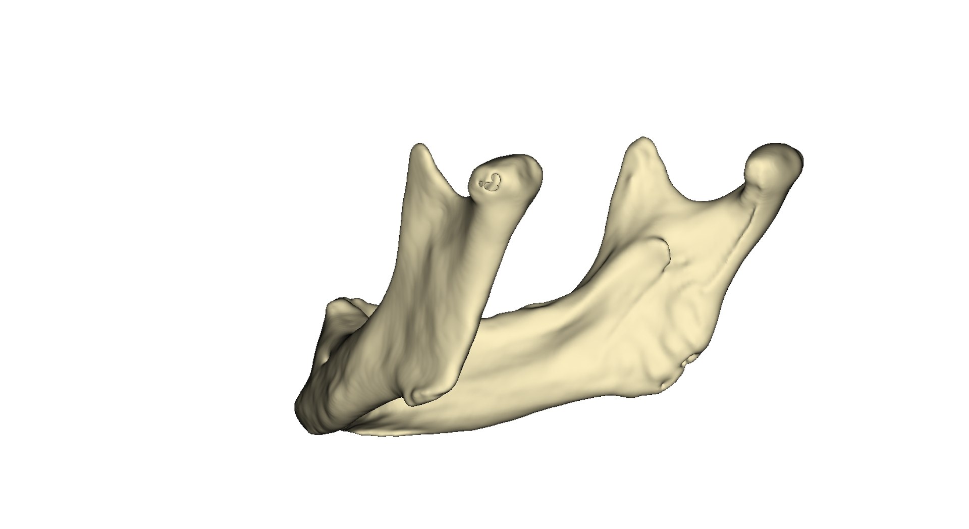 3d Edentulous Human Mandible