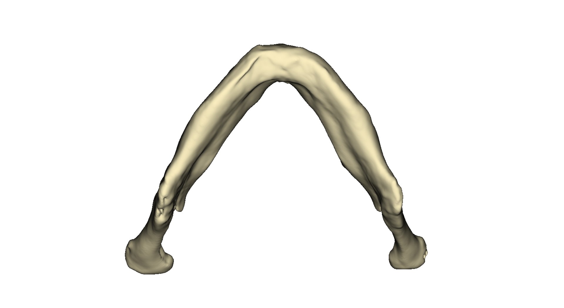 3d Edentulous Human Mandible