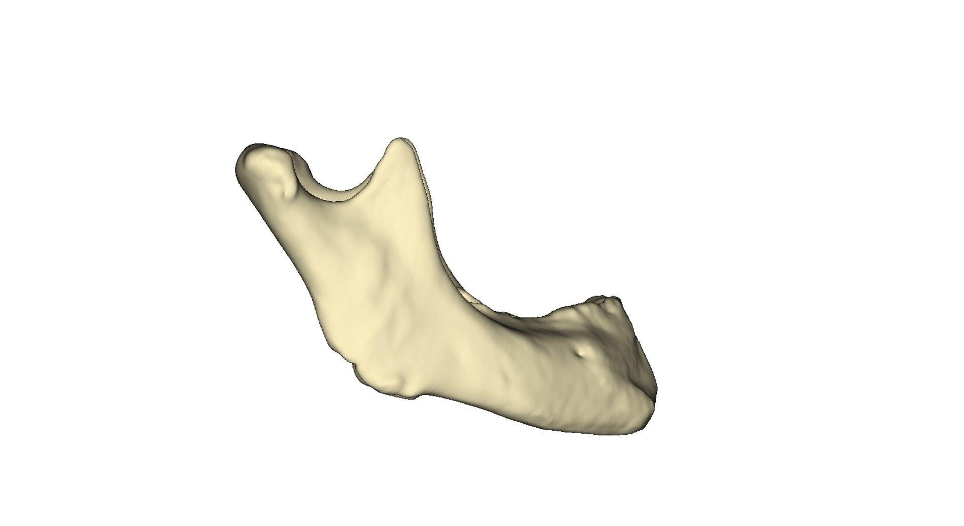 3d Edentulous Human Mandible