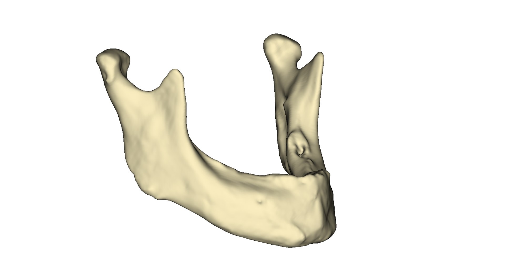 3d Edentulous Human Mandible