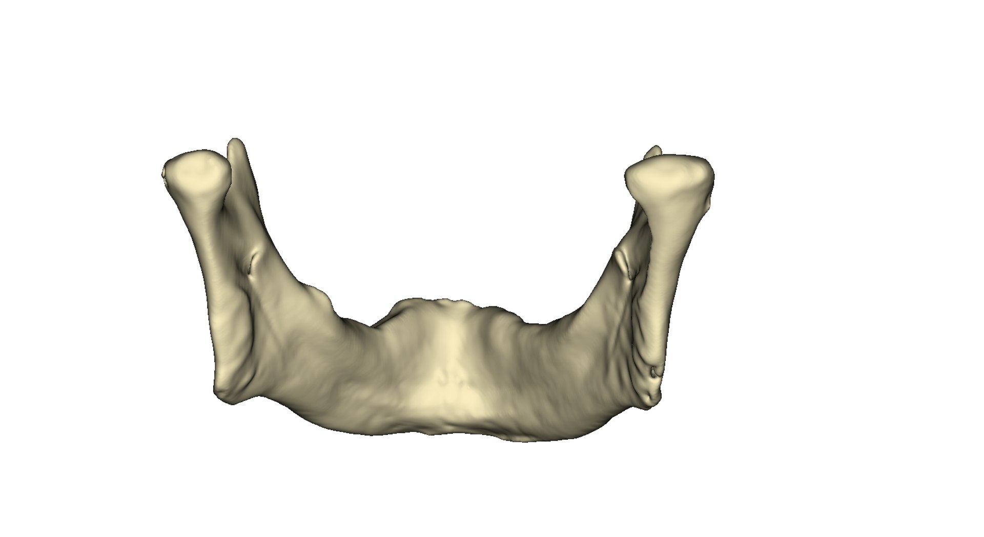 3d Edentulous Human Mandible