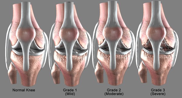 3D Knee Models | TurboSquid