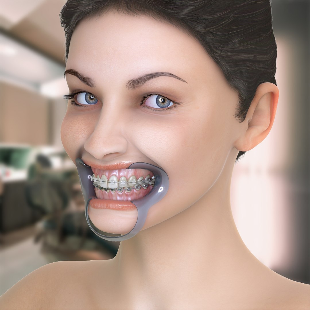 3d Female Orthodontic Teeth Face