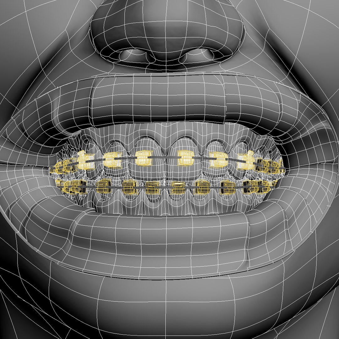 3d female orthodontic teeth face