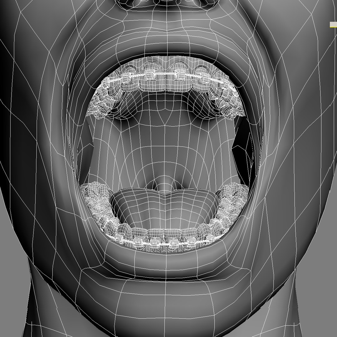 3d female orthodontic teeth face