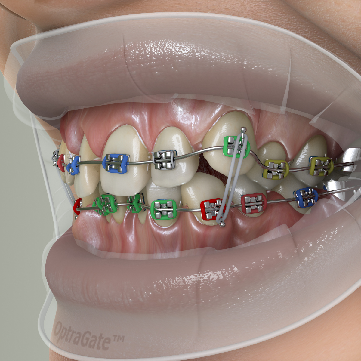 3d female orthodontic teeth face