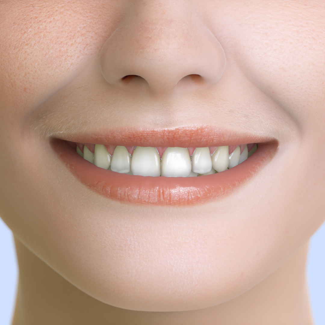 3d female orthodontic teeth face
