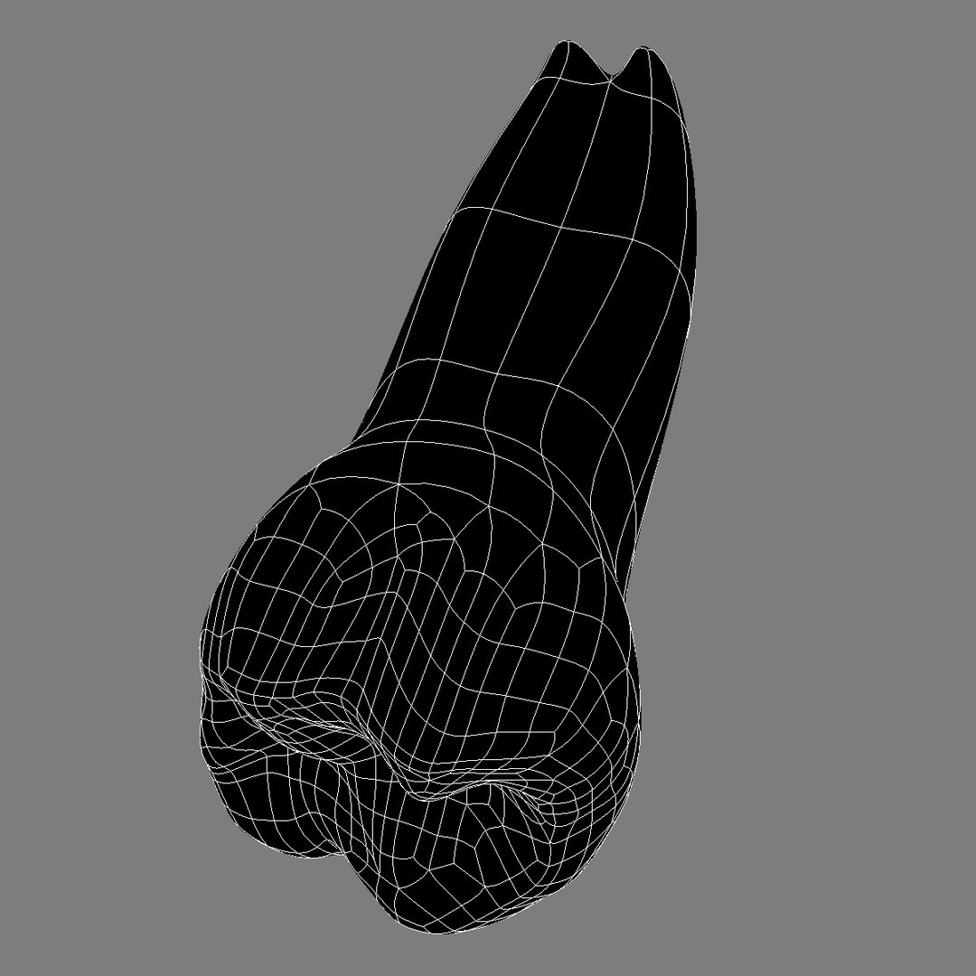 Tooth Upper Molar Wisdom 3d Model