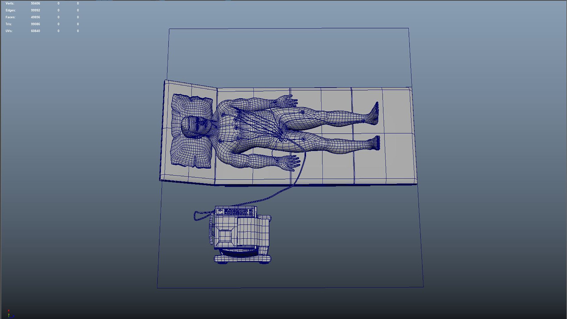Ecg Machine With Patient 3D - TurboSquid 2307958