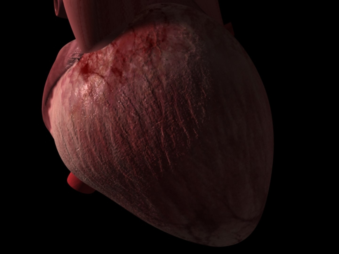 3d Model Of Atrium Ventricle Pulmonary