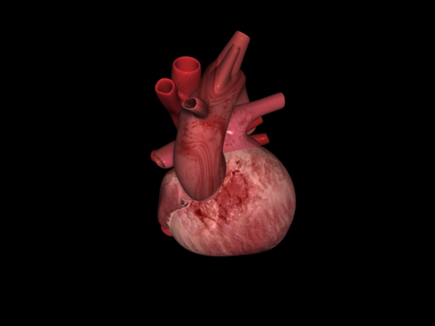 3d Model Of Atrium Ventricle Pulmonary