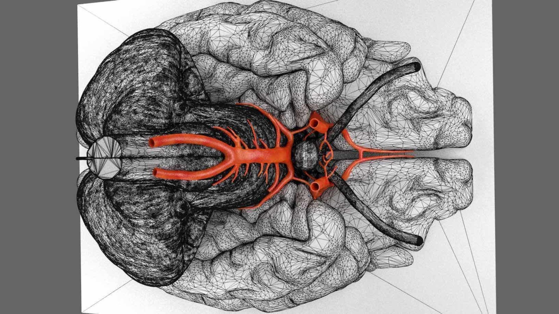 3D CIRCLE OF WILLIS 3D Model - TurboSquid 2046081