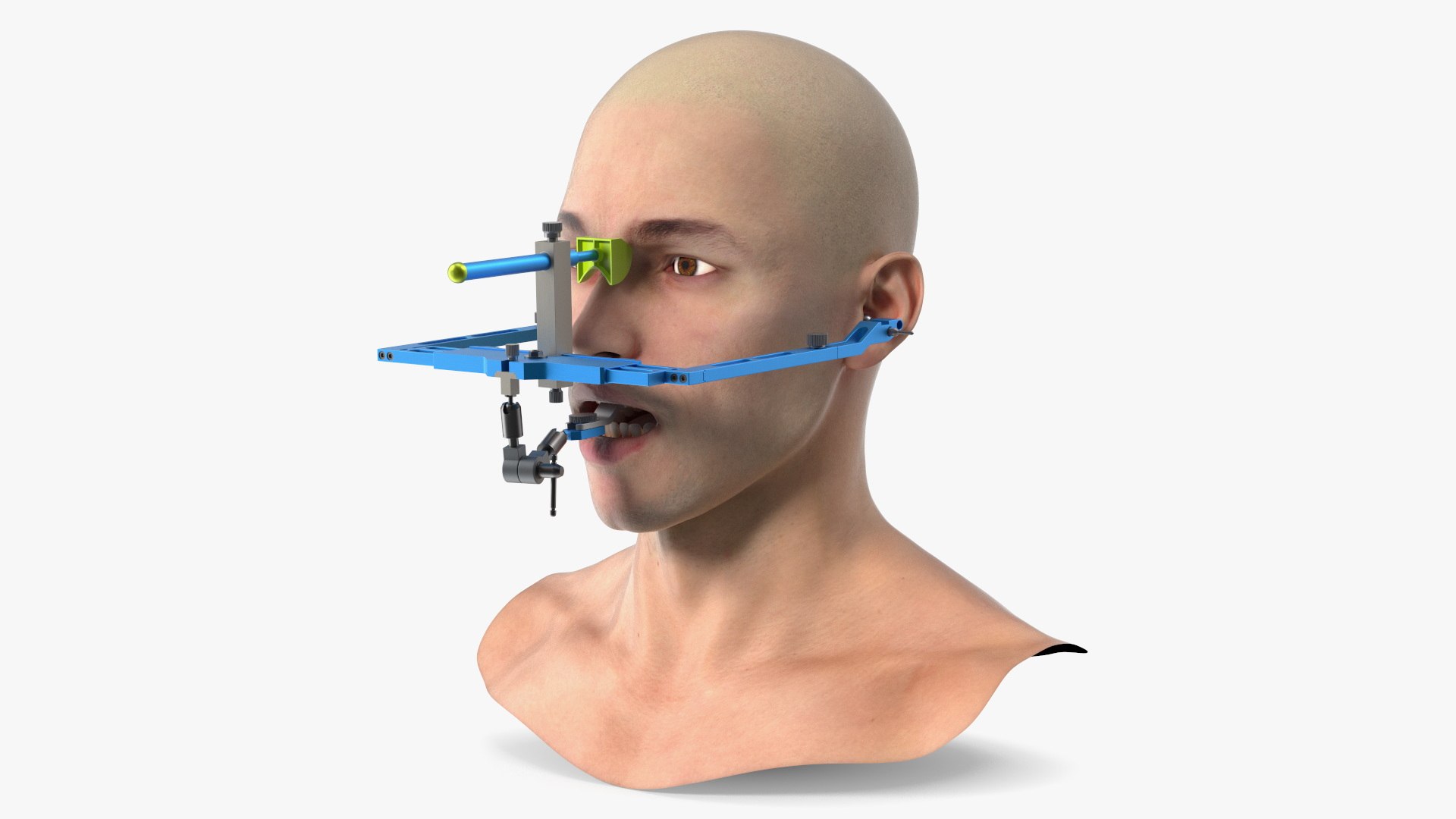 3D Human Head With Orthodontic Facebow Blue Model - TurboSquid 2437510