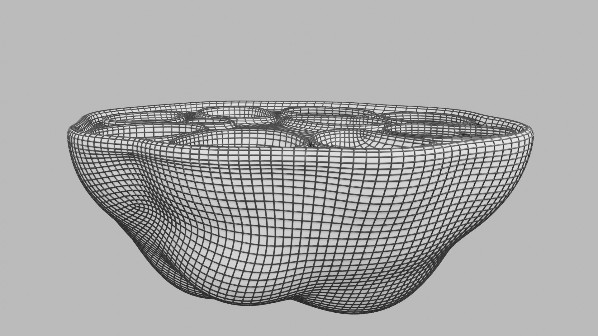 Polycystic Ovary Disease PCOD Model - TurboSquid 2296028