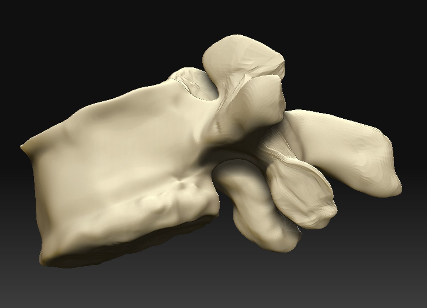 Lumbar Vertebra 3d Model