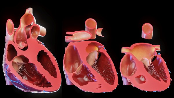 modelo 3d Anatomía Humana Completa Hombre Obeso - TurboSquid 2029369